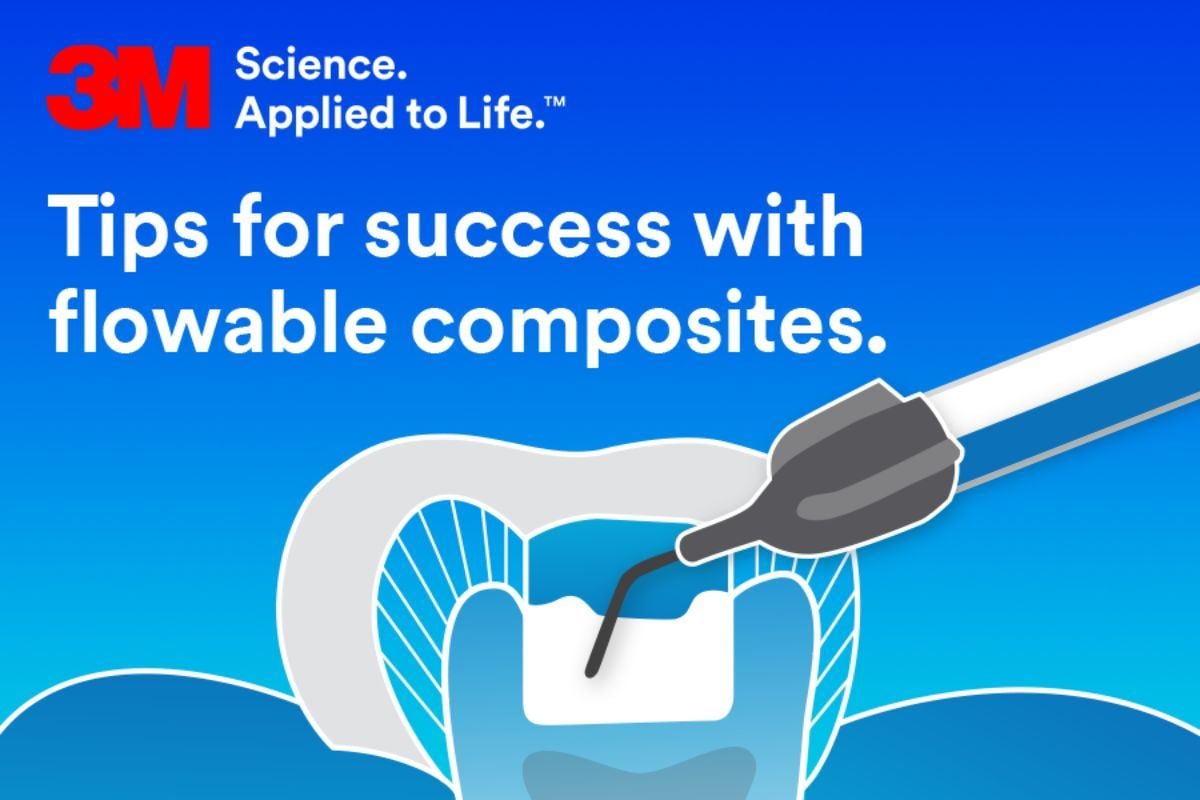 Tips for suksess med flytende kompositt
