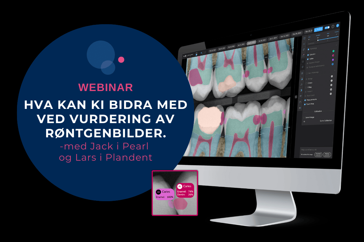 WEBINAR: Hva kan KI bidra med ved vurdering av røntgenbilder