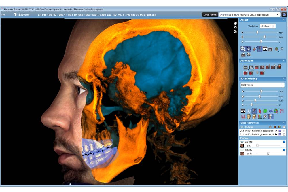 Romexis 3D programvare