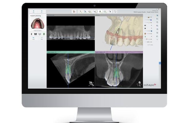 3Shape Trios Design Studio