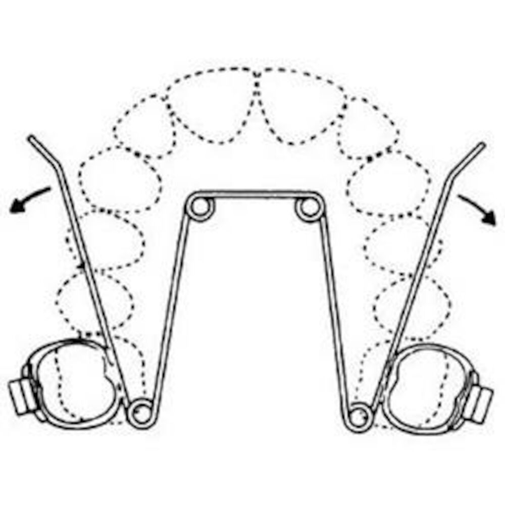 RMO Quad Helix 3 A 512 1 x 3 stk — NO1