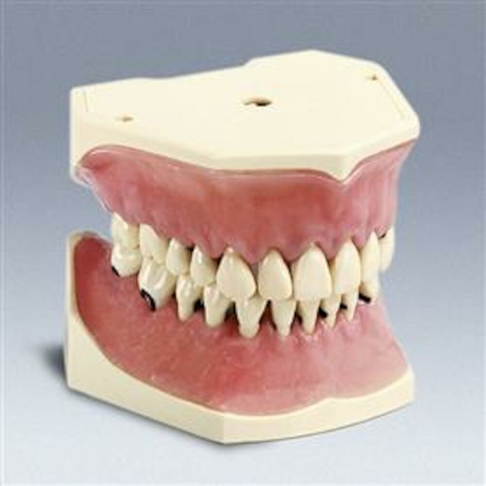 Frasaco A-Pz modell perio kpl 1 x 1 stk — NO1