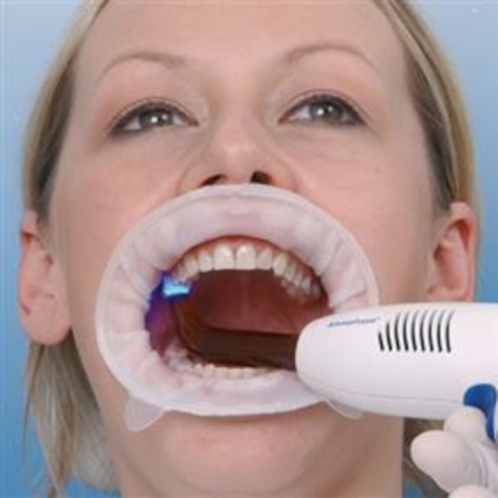 OptraGate refill regular 1 x 80 stk — NO1