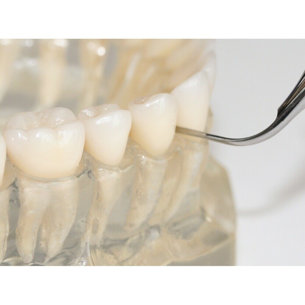 LM ProPower PE-41PF scaler spiss/tip 1 x 1 stk — NO1